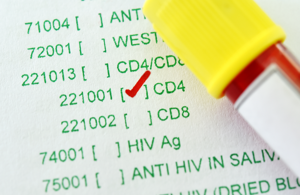 Diagnosed with HIV at a low CD4 count | aidsmap