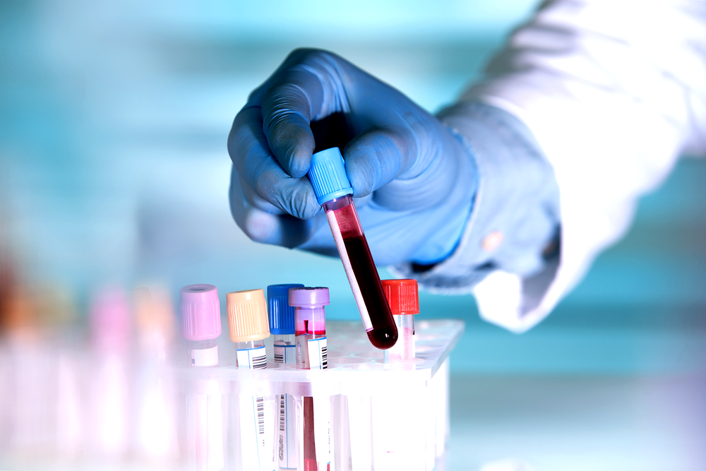 Gammora does not cure HIV | aidsmap