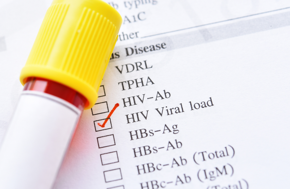 Low-level HIV and viral load blips are important warning signals ...